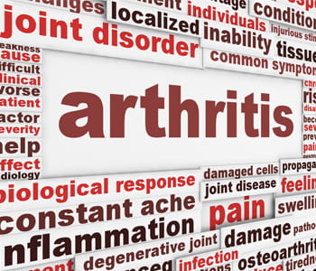 Understanding rheumatology & arthritis - Mayo Clinic Health System