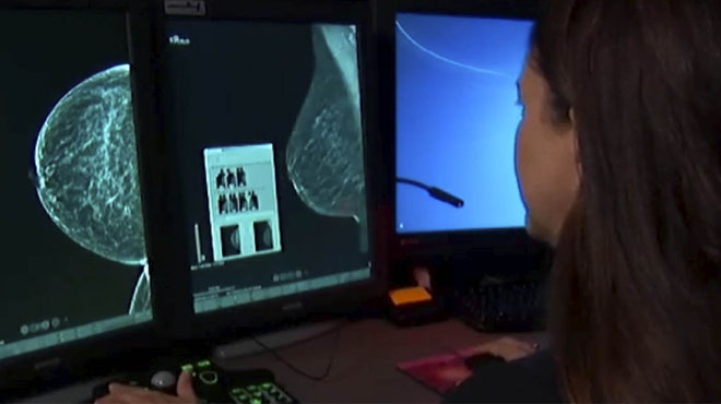 3D technology to detect breast cancer - Mayo Clinic Health System